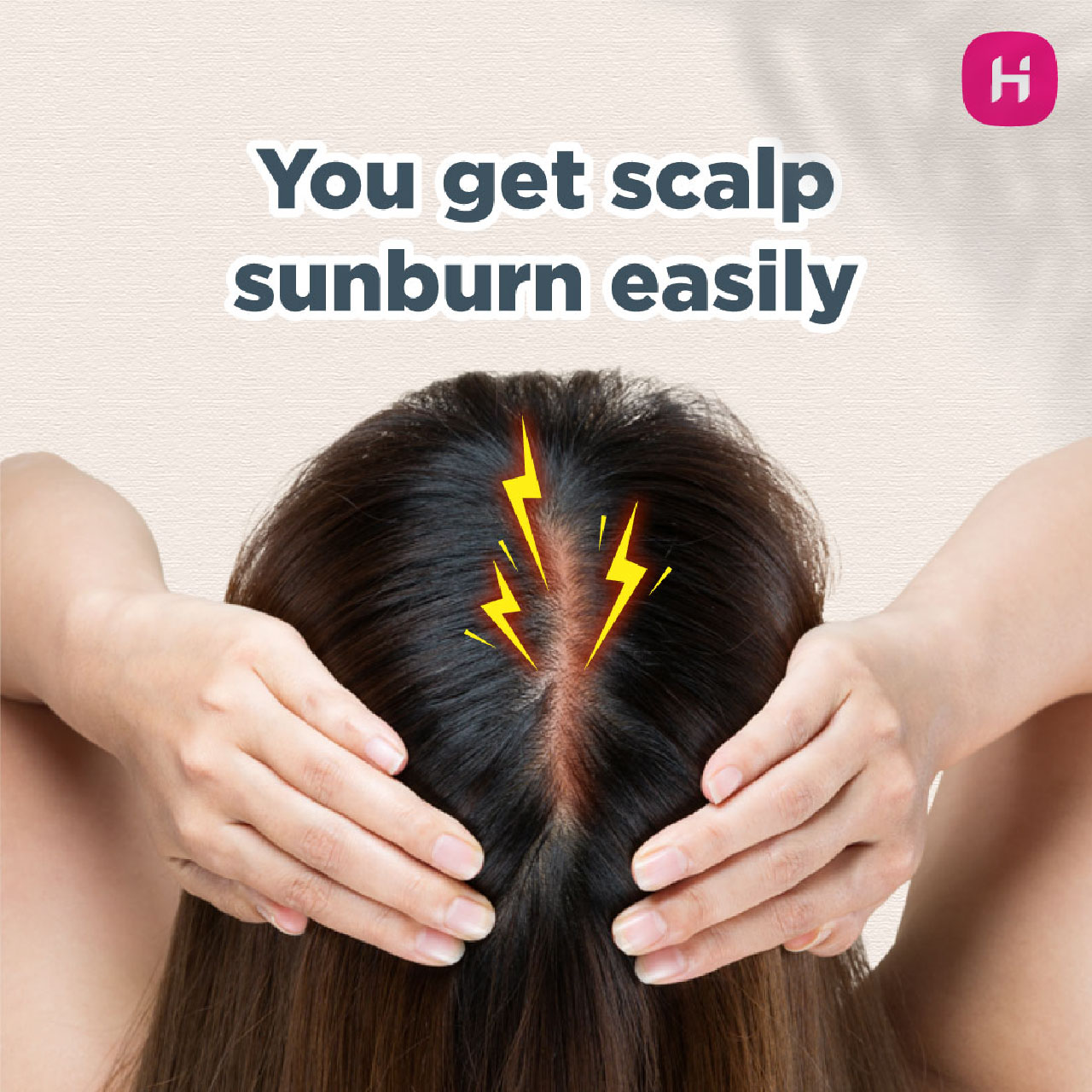 Thin Hair Problems | HAIRDEPOT