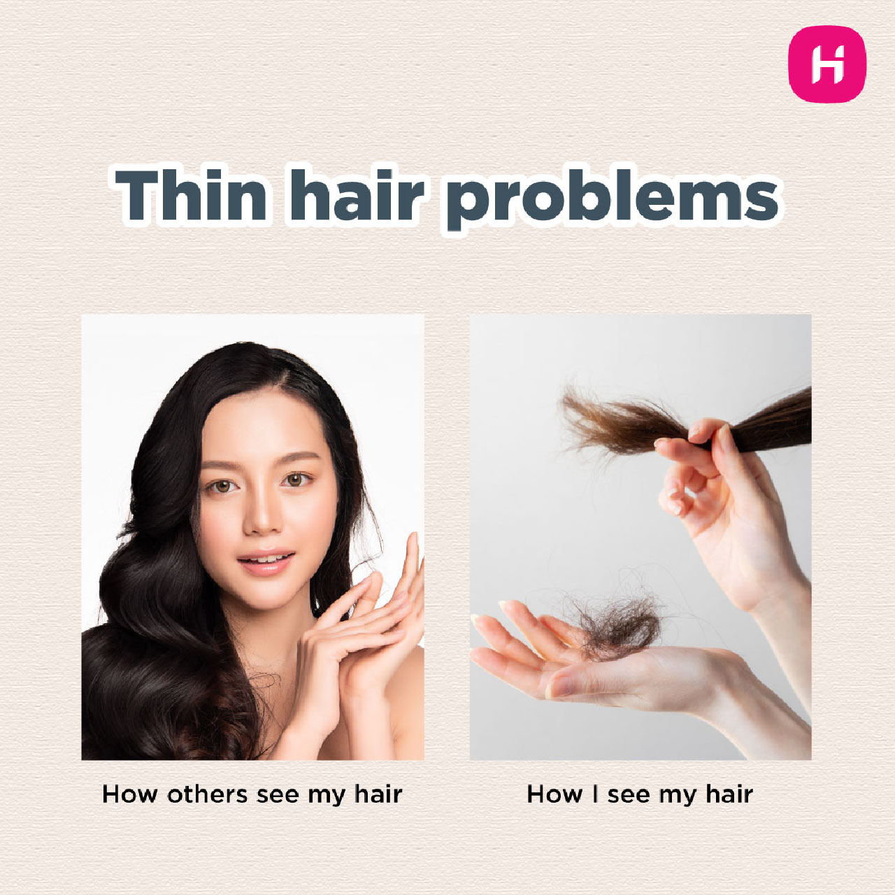 Thin Hair Problems | HAIRDEPOT