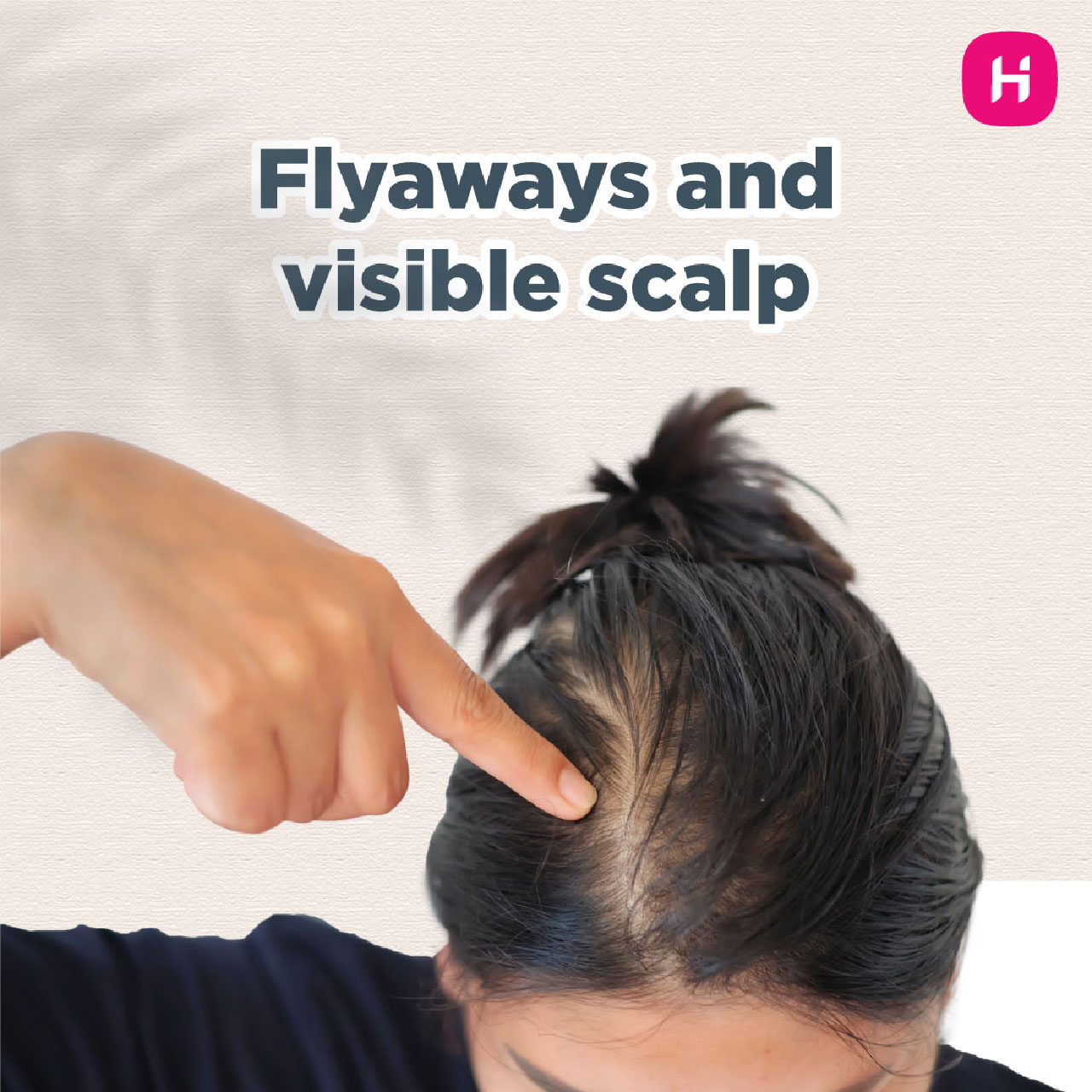 Thin Hair Problems | HAIRDEPOT